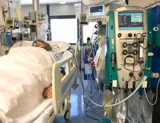Dializy pozaustrojowe i otrzewnowe | Leczenie niewydolnych nerek